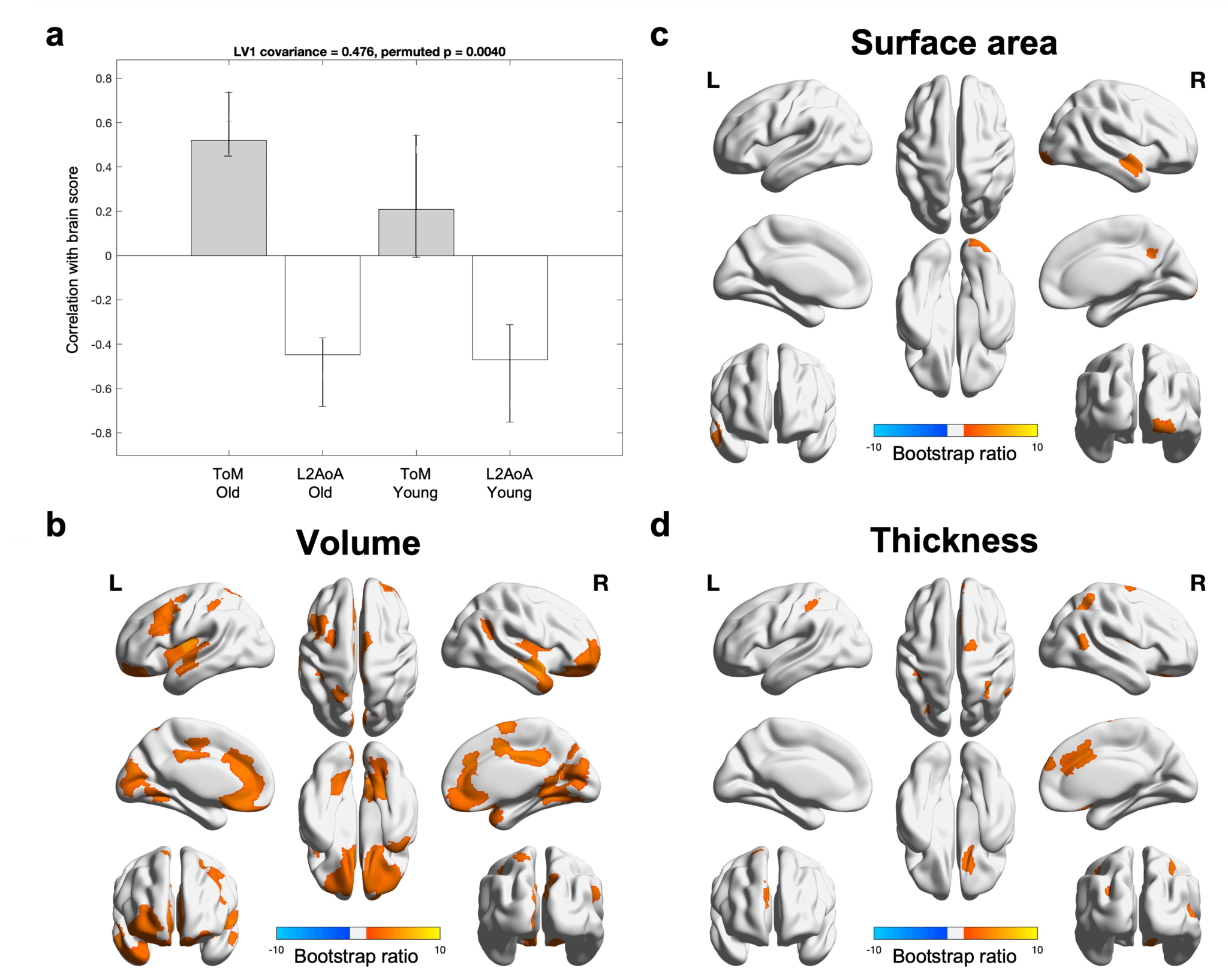 The Bilingual Brain: Learning A Second Language Early May Slow ...